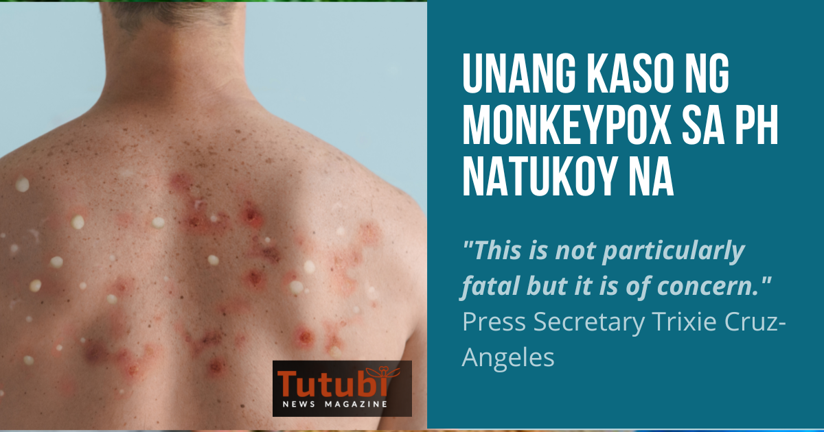 Natukoy na ang unang kaso ng monkeypox sa PH - Tutubi News