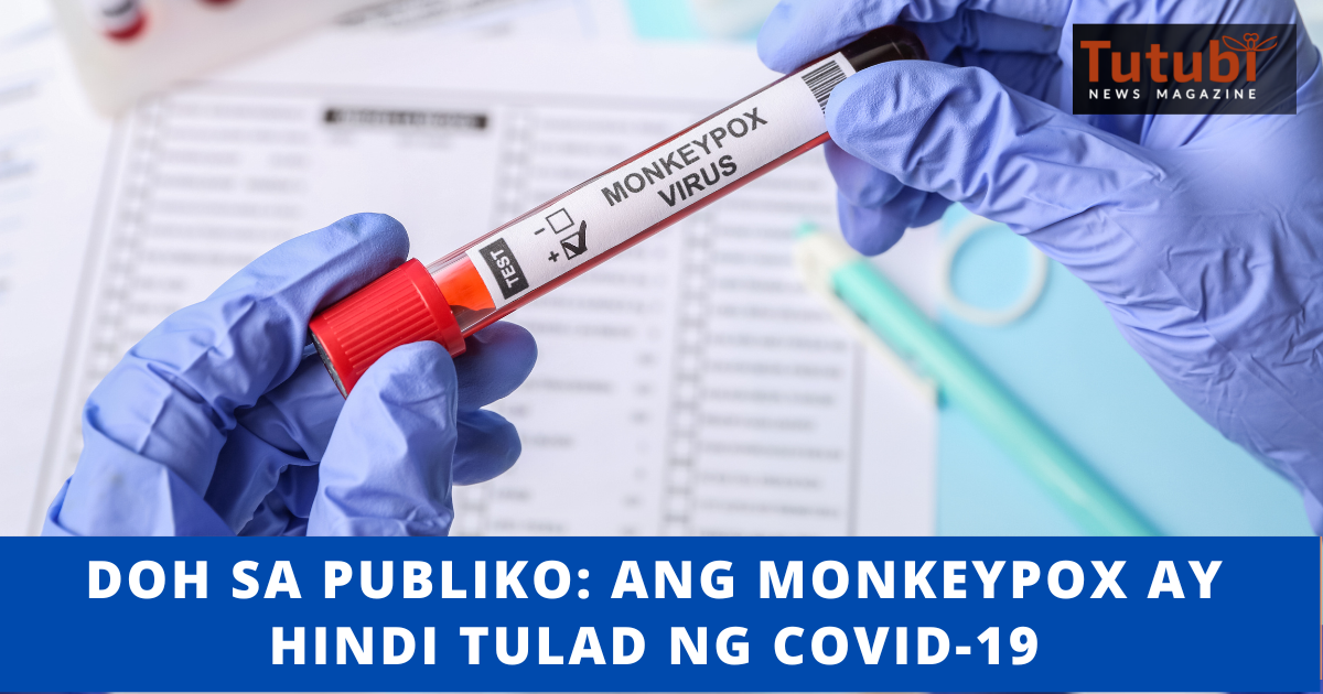 DOH sa publiko: Ang monkeypox ay hindi tulad ng COVID-19 - Tutubi News