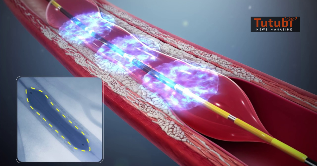 J&J bolsters MedTech arm with $13B shockwave deal - Tutubi News