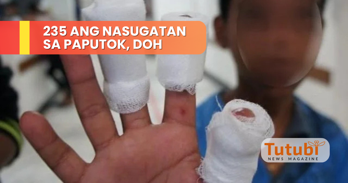 235 ang naitala ng DOH na nasugatan sa paputok - Tutubi News